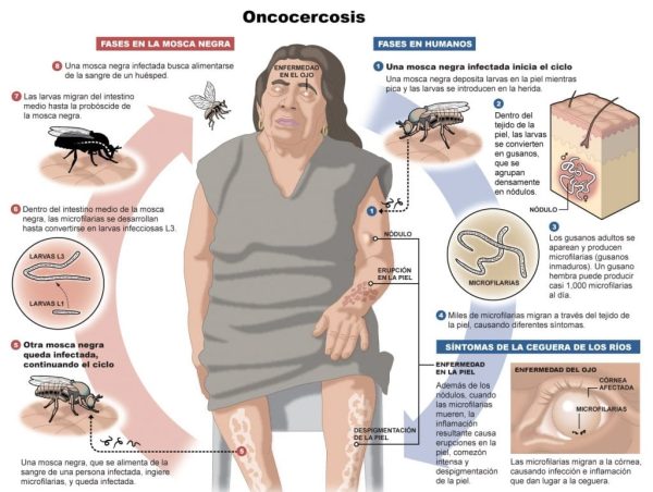 Oncocercosis – Otra enfermedad transmitida por las moscas - Fumigación Universal, C.A