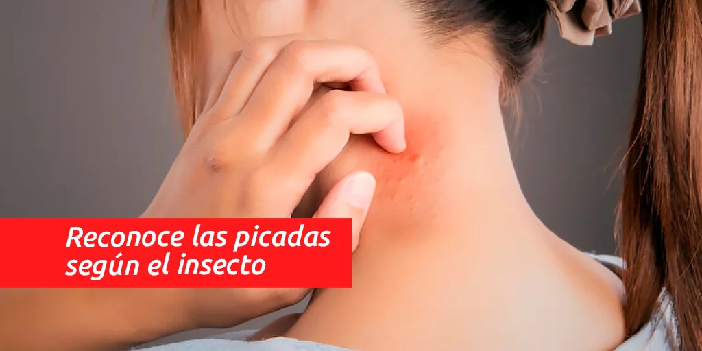 Reconoce las picadas según el insecto - Fumigación Universal, C.A